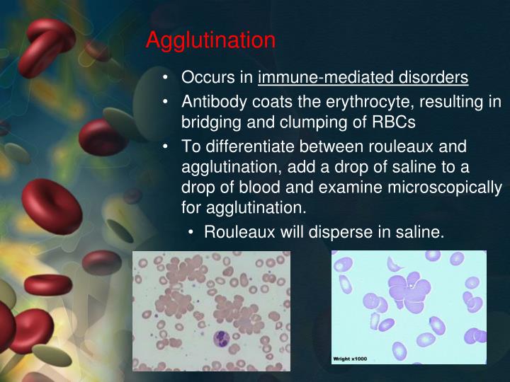 PPT - Hematology PowerPoint Presentation - ID:3074089