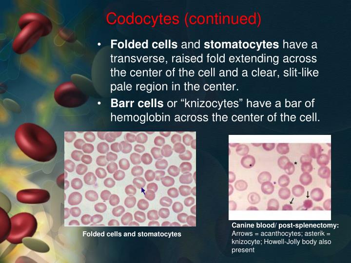 PPT - Hematology PowerPoint Presentation - ID:3074089