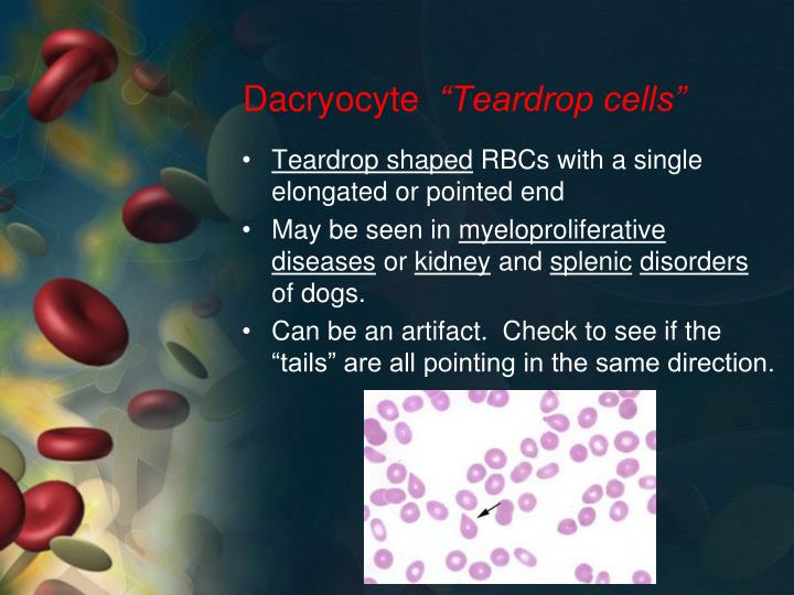 PPT - Hematology PowerPoint Presentation - ID:3074089
