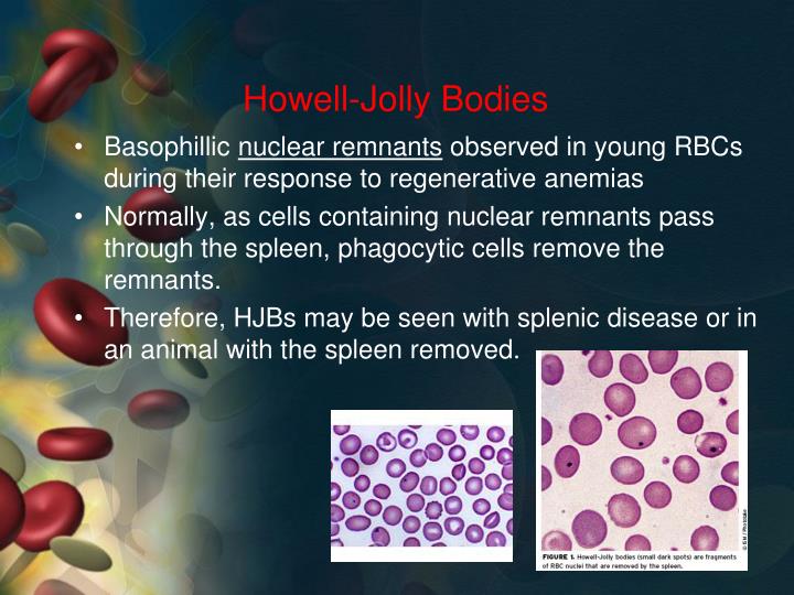 PPT - Hematology PowerPoint Presentation - ID:3074089