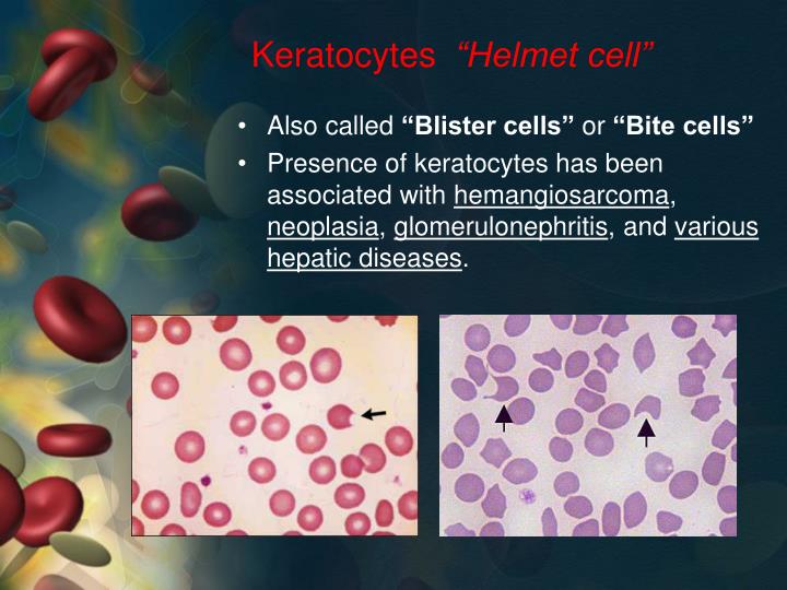PPT - Hematology PowerPoint Presentation - ID:3074089