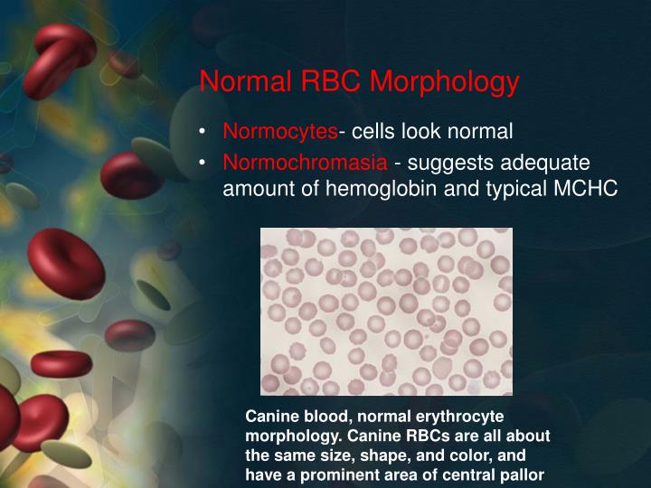 PPT - Hematology PowerPoint Presentation - ID:3074089