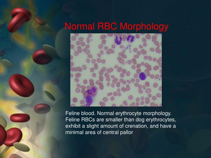 PPT - Hematology PowerPoint Presentation - ID:3074089