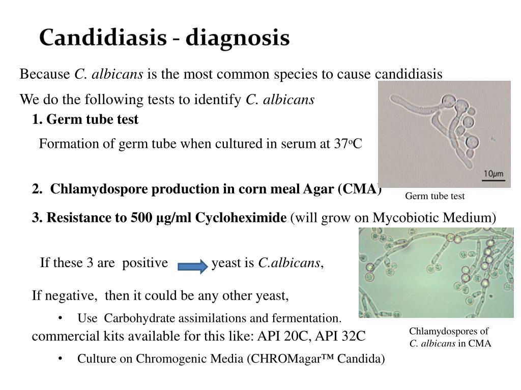 PPT - Respiratory Fungal Infections-II PowerPoint Presentation, free ...