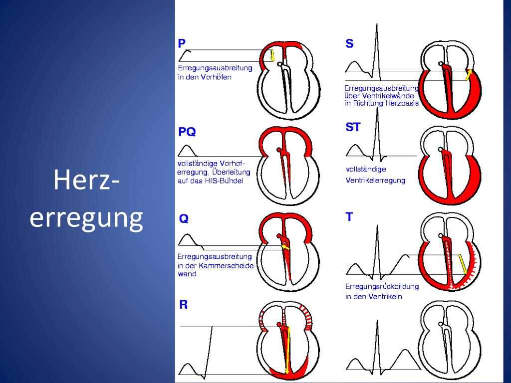 PPT - Herzlich Willkommen! zu: EKG verstehen und bewerten PowerPoint ...