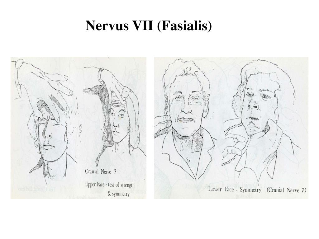 PPT - ANAMNESA dan PEMERIKSAAN FISIK NEUROLOGI PowerPoint Presentation ...