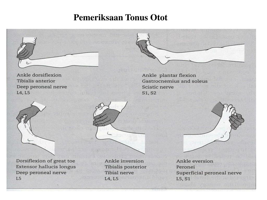 PPT - ANAMNESA dan PEMERIKSAAN FISIK NEUROLOGI PowerPoint Presentation ...