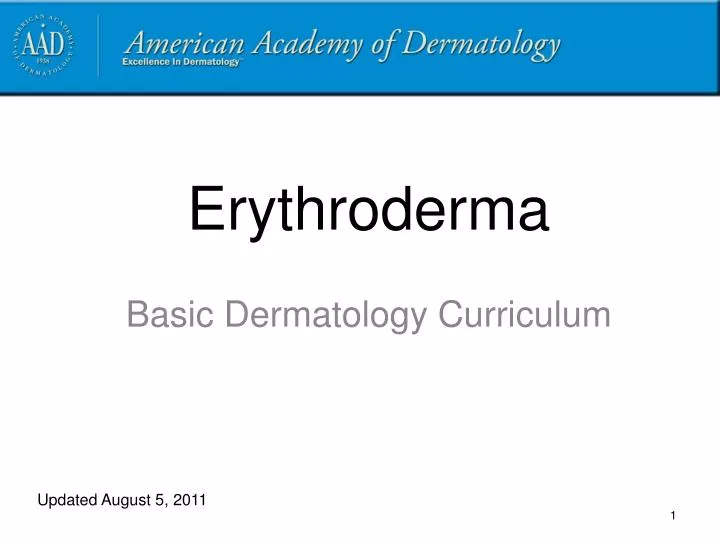 PPT - Erythroderma PowerPoint Presentation, free download - ID:3077910