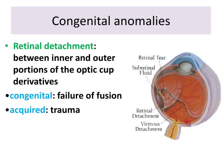 PPT - Development of the eye and ear PowerPoint Presentation - ID:3078175