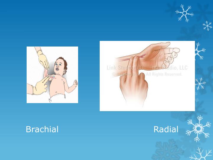 PPT - Pulse PowerPoint Presentation - ID:3078800