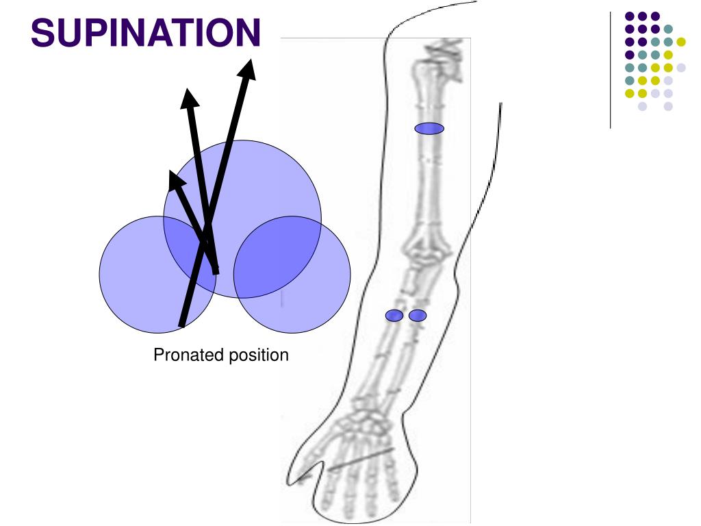 PPT - The Elbow and Radioulnar Joints PowerPoint Presentation, free ...