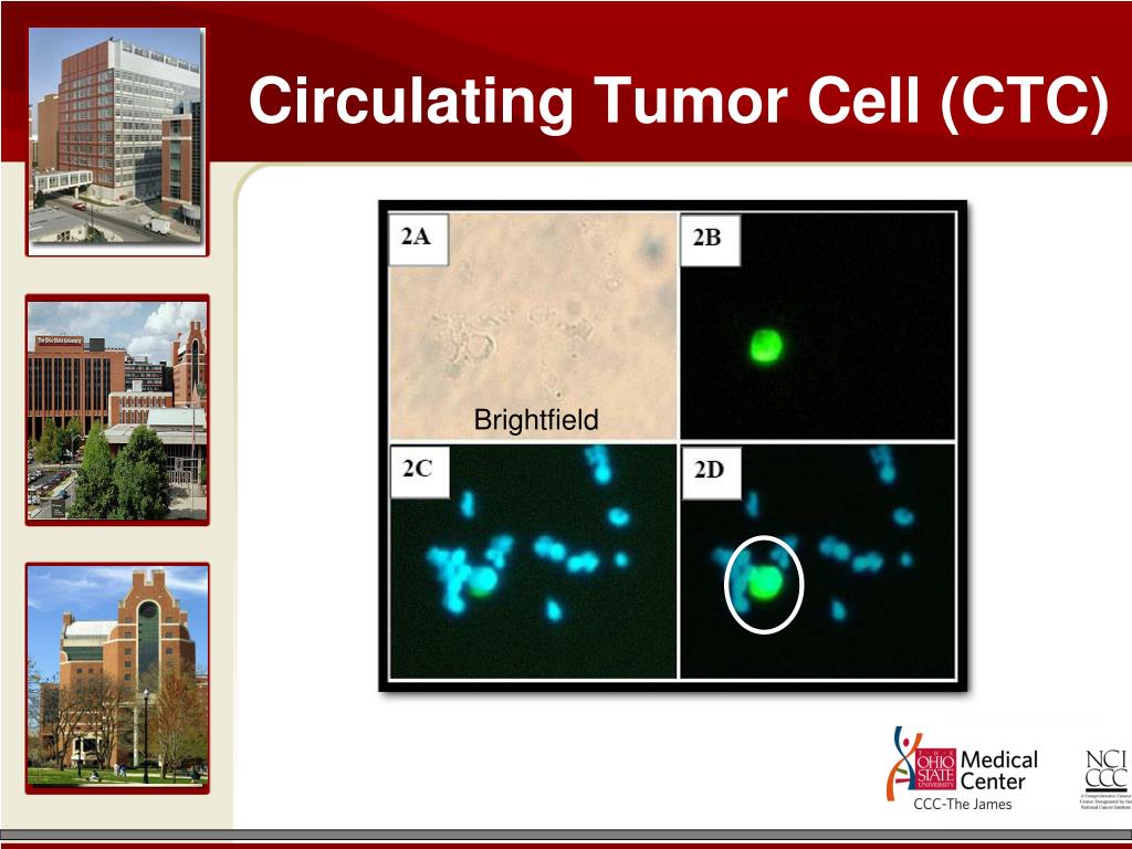 PPT - Kris R. Jatana , M.D . Department of Otolaryngology—Head & Neck ...