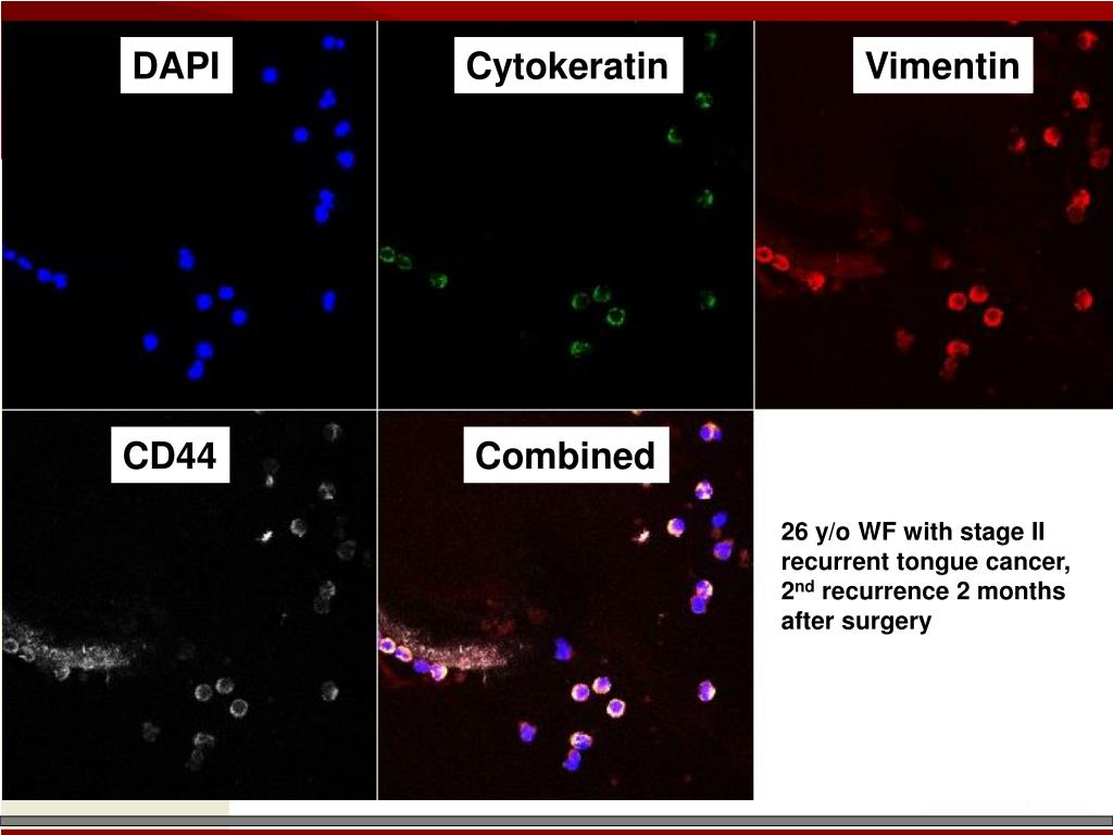 PPT - Kris R. Jatana , M.D . Department of Otolaryngology—Head & Neck ...