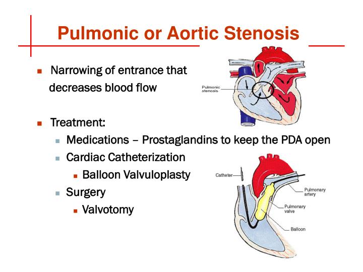 PPT - Module 5 – Pediatric Cardiac Disorders PowerPoint Presentation ...