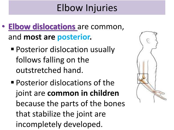 PPT - Elbow Joint PowerPoint Presentation - ID:3084731
