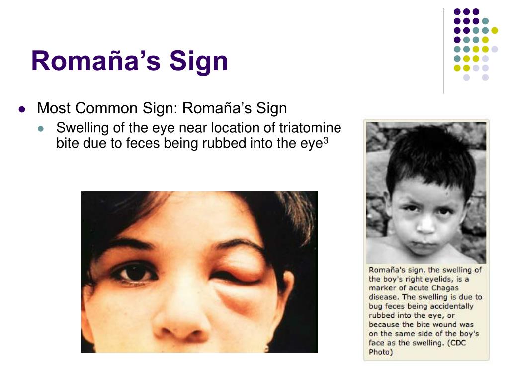 PPT - Chagas’ Disease American trypanosomiasis PowerPoint Presentation ...