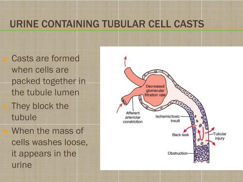 PPT - Chapter 26 Acute Renal Failure and Chronic Kidney Disease ...