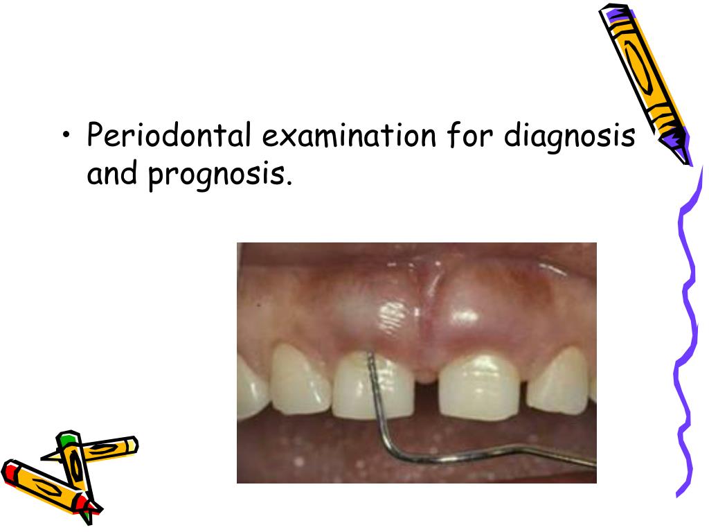 PPT - Endodontic diagnosis and treatment planning PowerPoint ...