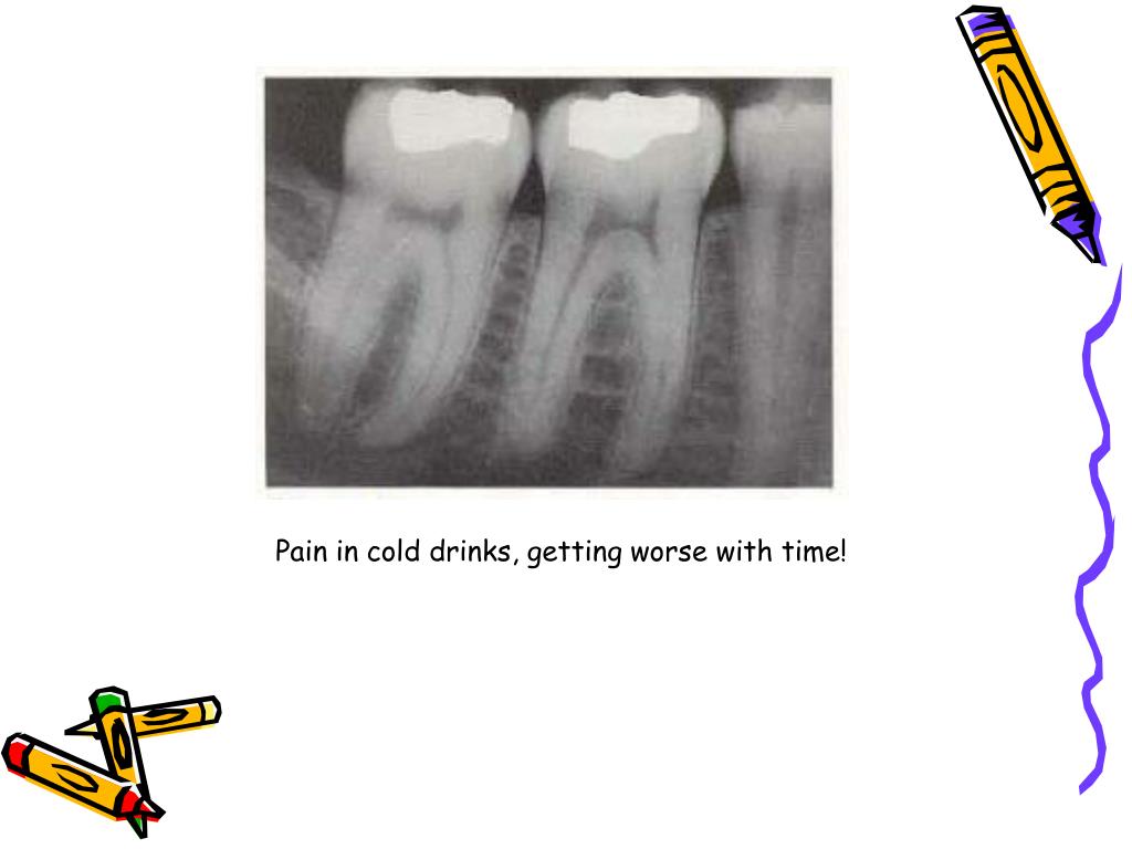 PPT - Endodontic diagnosis and treatment planning PowerPoint ...