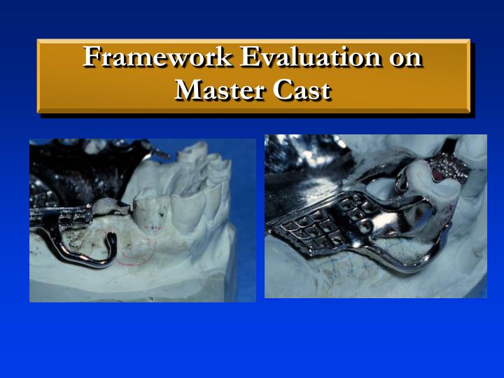 PPT - Surveying the Master cast & Framework Fabrication PowerPoint ...