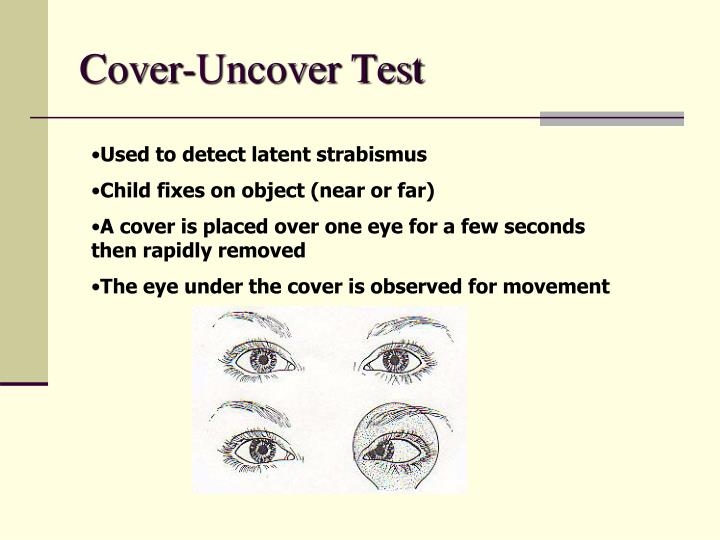PPT - Ocular Motility PowerPoint Presentation - ID:3089090