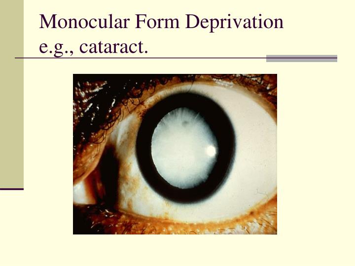 PPT - Ocular Motility PowerPoint Presentation - ID:3089090