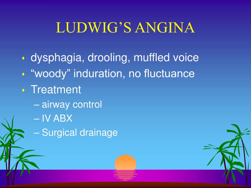 PPT - Deep Neck Space Abscesses and Life-Threatening Infections of the ...