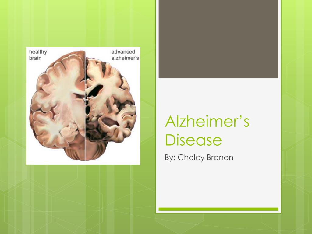 PPT - Alzheimer’s Disease PowerPoint Presentation, free download - ID ...