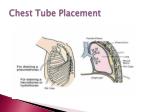 PPT - Chest Tubes PowerPoint Presentation - ID:3090007