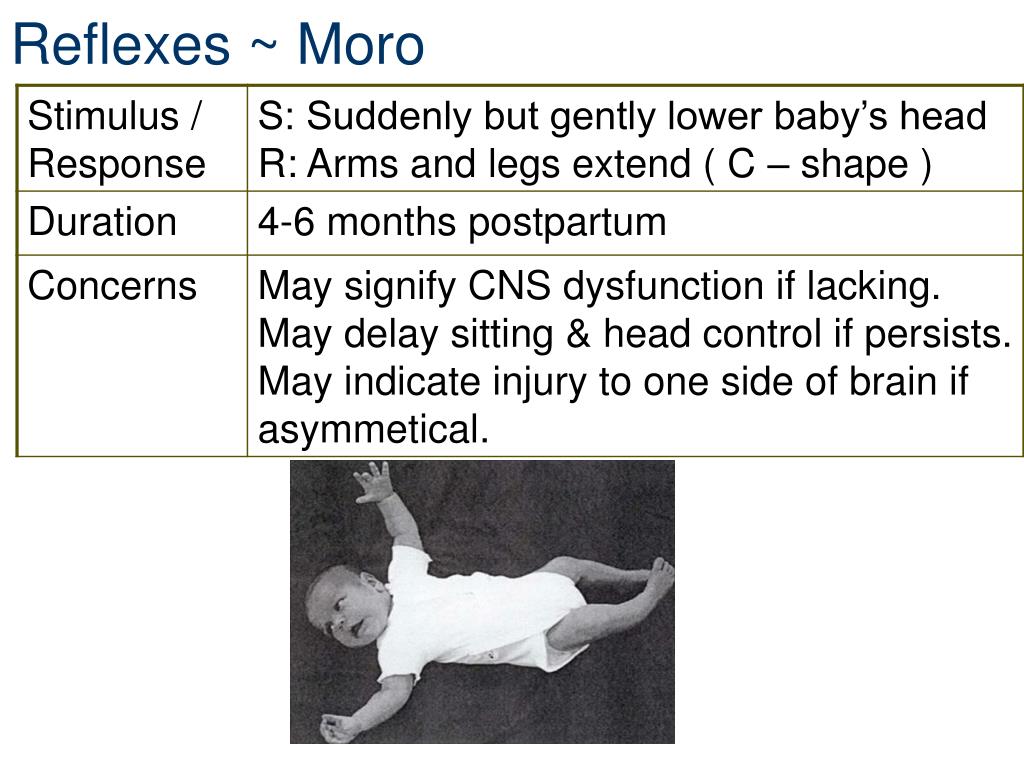 PPT - Infant Reflexes Prepared by : Emad al Khatib PowerPoint ...
