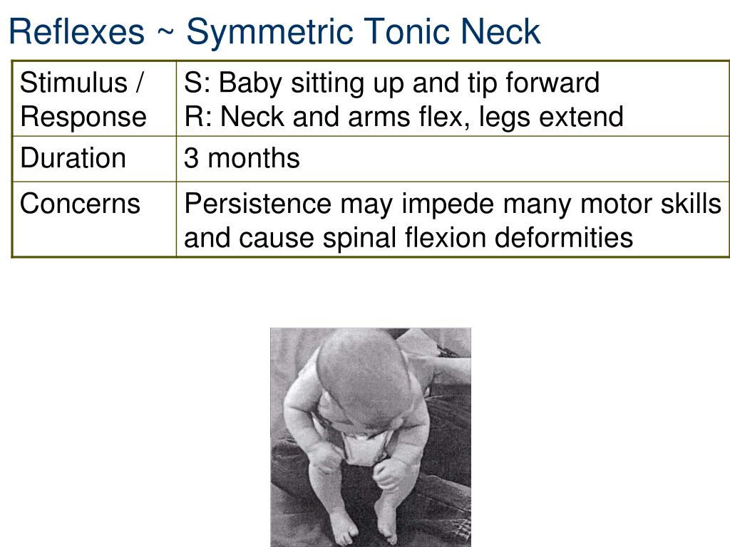 PPT - Infant Reflexes Prepared by : Emad al Khatib PowerPoint ...