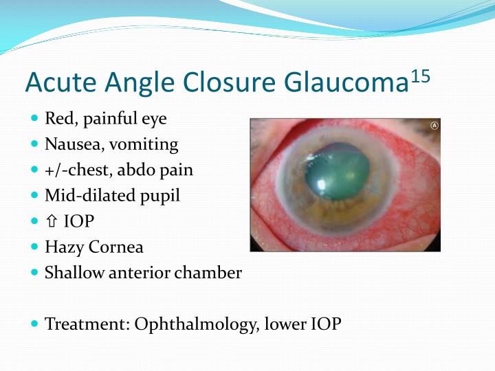 PPT - The Basic Ophthalmic Assessment PowerPoint Presentation - ID:3091964