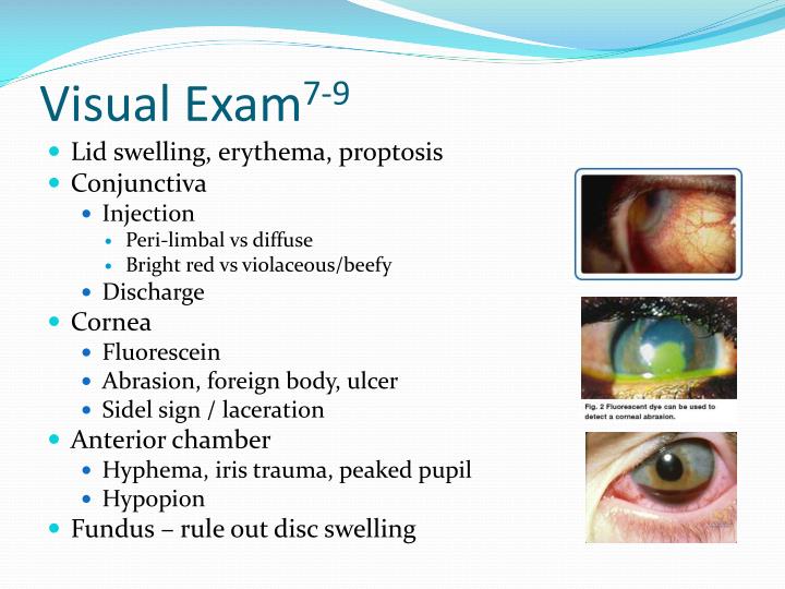 PPT - The Basic Ophthalmic Assessment PowerPoint Presentation - ID:3091964