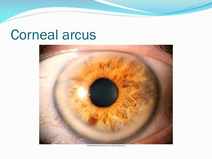 PPT - Direct ophthalmoscopy PowerPoint Presentation - ID:3092065