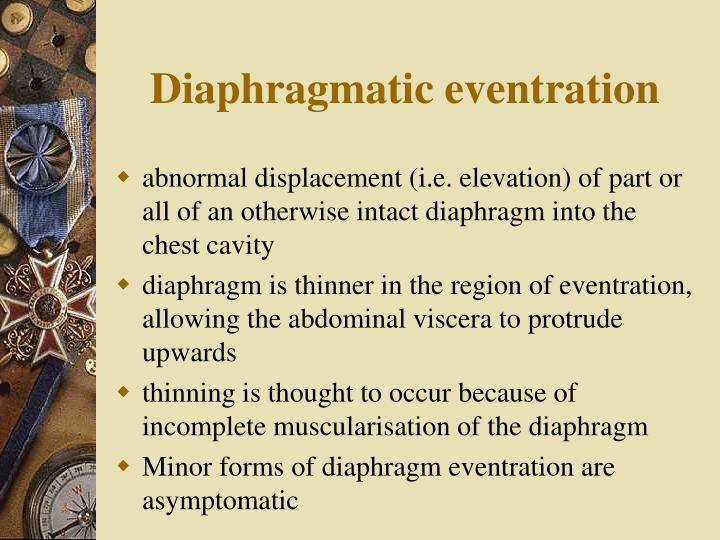PPT - DIAPHRAGM AND HIATUS HERNIA PowerPoint Presentation - ID:3094188