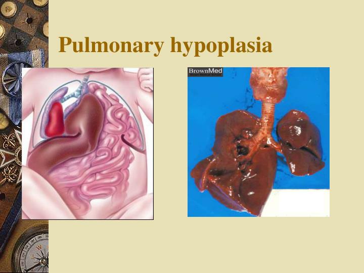 PPT - DIAPHRAGM AND HIATUS HERNIA PowerPoint Presentation - ID:3094188