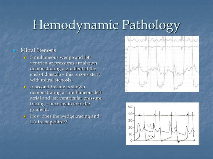 PPT - Right Heart Catheterization – basic right heart pressure tracings ...
