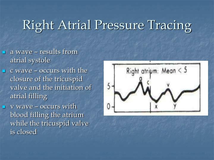 PPT - Right Heart Catheterization – basic right heart pressure tracings ...