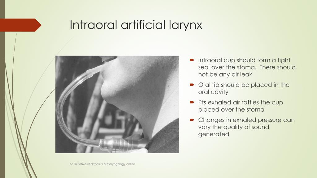 PPT - Voice Rehabilitation following Laryngectomy PowerPoint ...