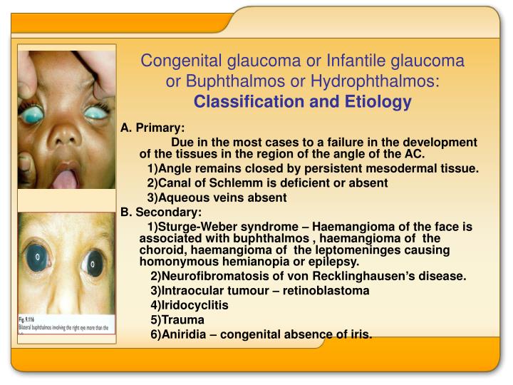 PPT - Glaucoma PowerPoint Presentation - ID:3096922