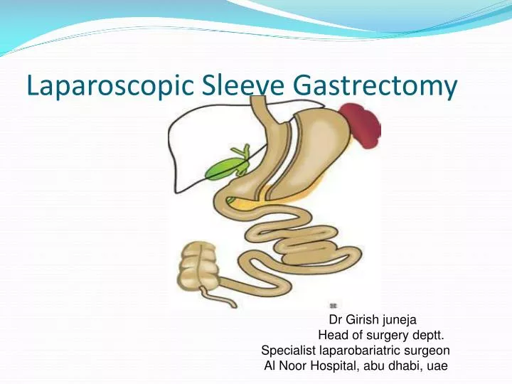 Ppt Laparoscopic Sleeve Gastrectomy Powerpoint Presentation Free