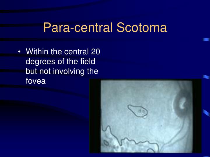 PPT - Anatomy/Neuro-Anatomy of the Visual System PowerPoint ...