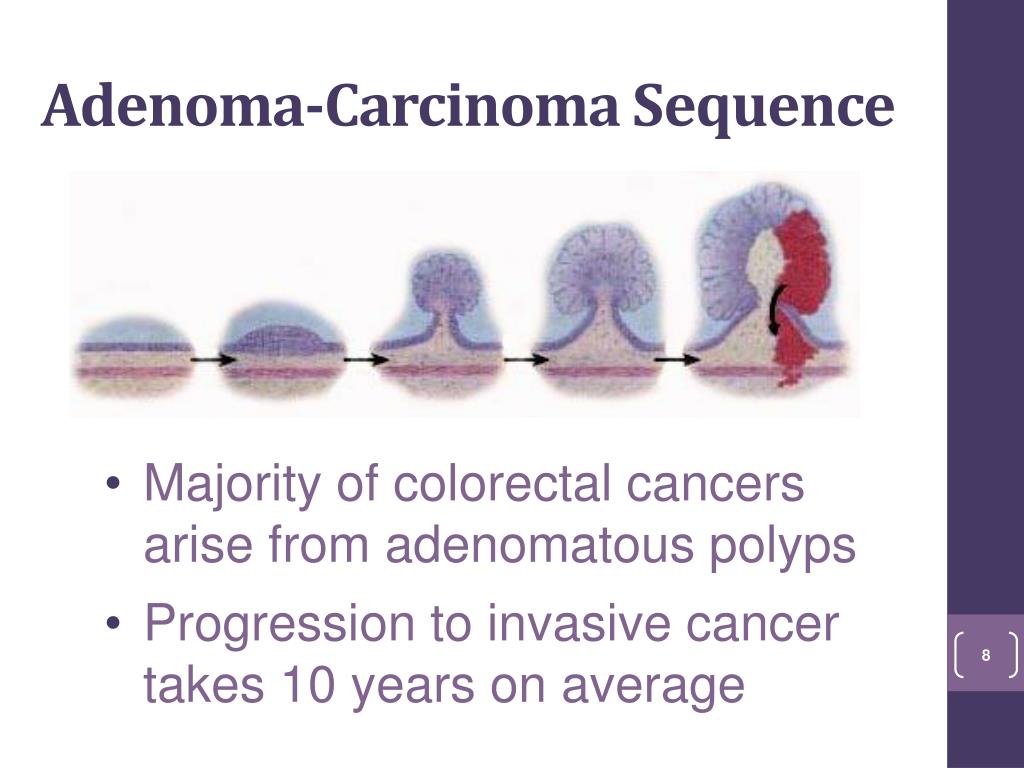 PPT - Spotlight on Colorectal Cancer Screening PowerPoint Presentation ...