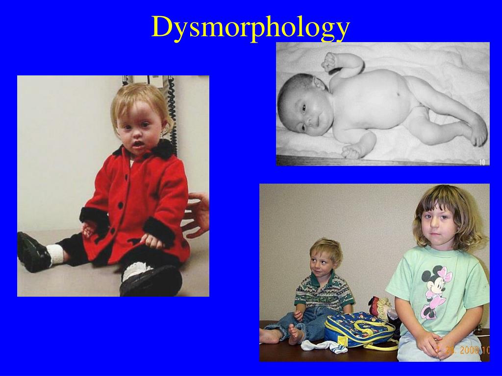 PPT - Medical Genetics in Pediatric Care: The Science of Medicine ...