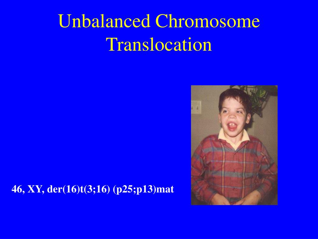 Unbalanced Translocation