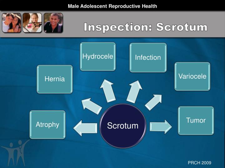 PPT - Male Adolescent Reproductive Health PowerPoint Presentation - ID ...