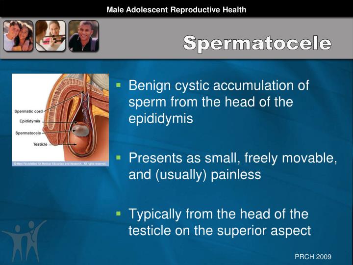 PPT - Male Adolescent Reproductive Health PowerPoint Presentation - ID:3108492