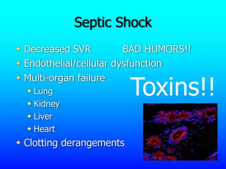 PPT - Surviving Sepsis PowerPoint Presentation - ID:3111790