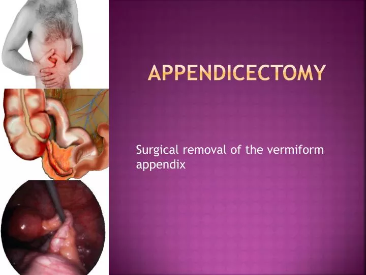 Ppt Appendicectomy Powerpoint Presentation Id 3112134