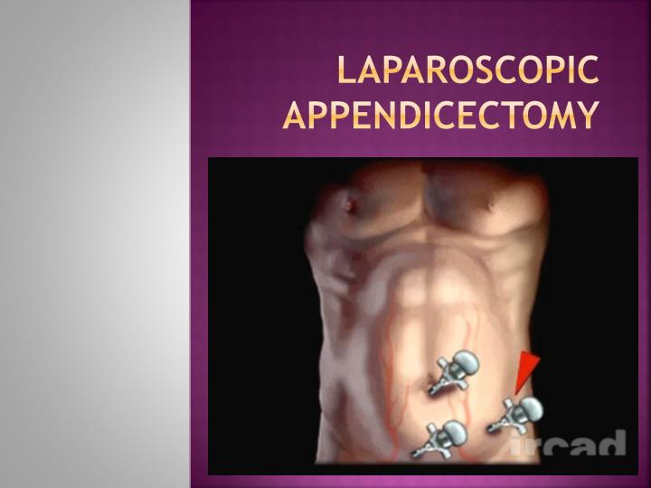 Ppt Appendicectomy Powerpoint Presentation Id 3112134